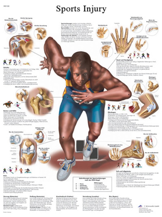 Anatomical Chart - Common Sports Injuries Chart, Laminated