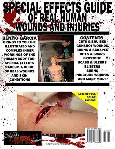 Buy Special Effects Guide of Real Human Wounds and Injuries Online